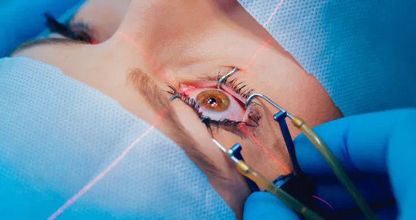 Eye Surgery - RBM Eye Institute